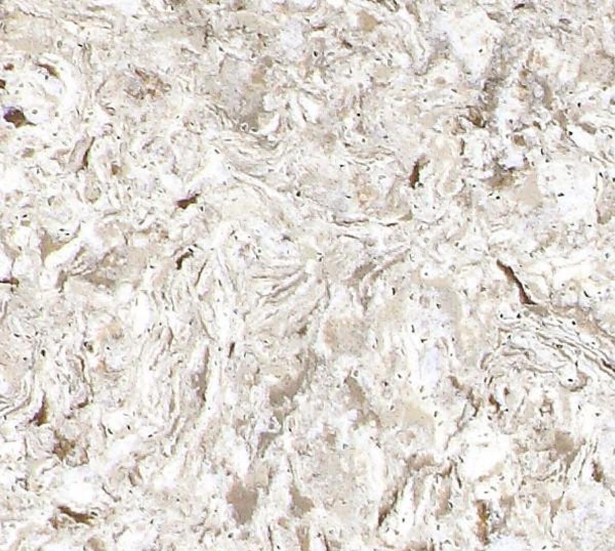Buy Custom Stargaze Quartz Countertops - Austin, TX